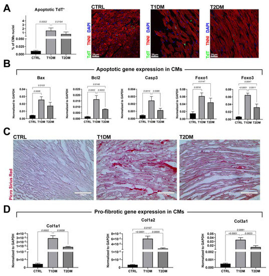 Streptozotocin-Induced Type 1 and 2 Diabetes Mellitus Mouse Models Show ...