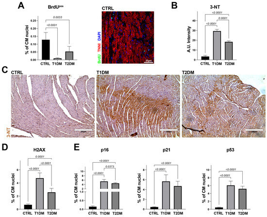 Streptozotocin-Induced Type 1 and 2 Diabetes Mellitus Mouse Models Show ...