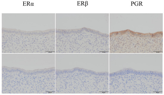 Subacute Ruminal Acidosis as a Potential Factor that Induces ...