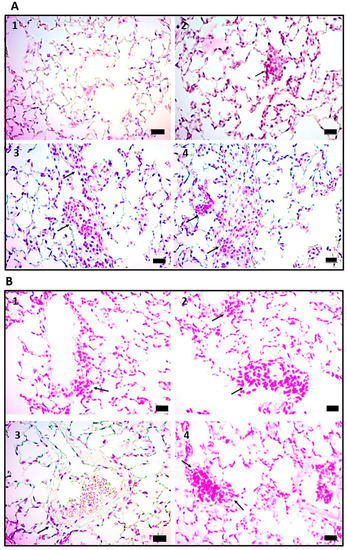 Mycobacterium tuberculosis Cell Wall Antigens Induce the Formation of ...