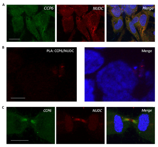 IJMS | Free Full-Text | Proximity Mapping of CCP6 Reveals Its Association with Centrosome ...