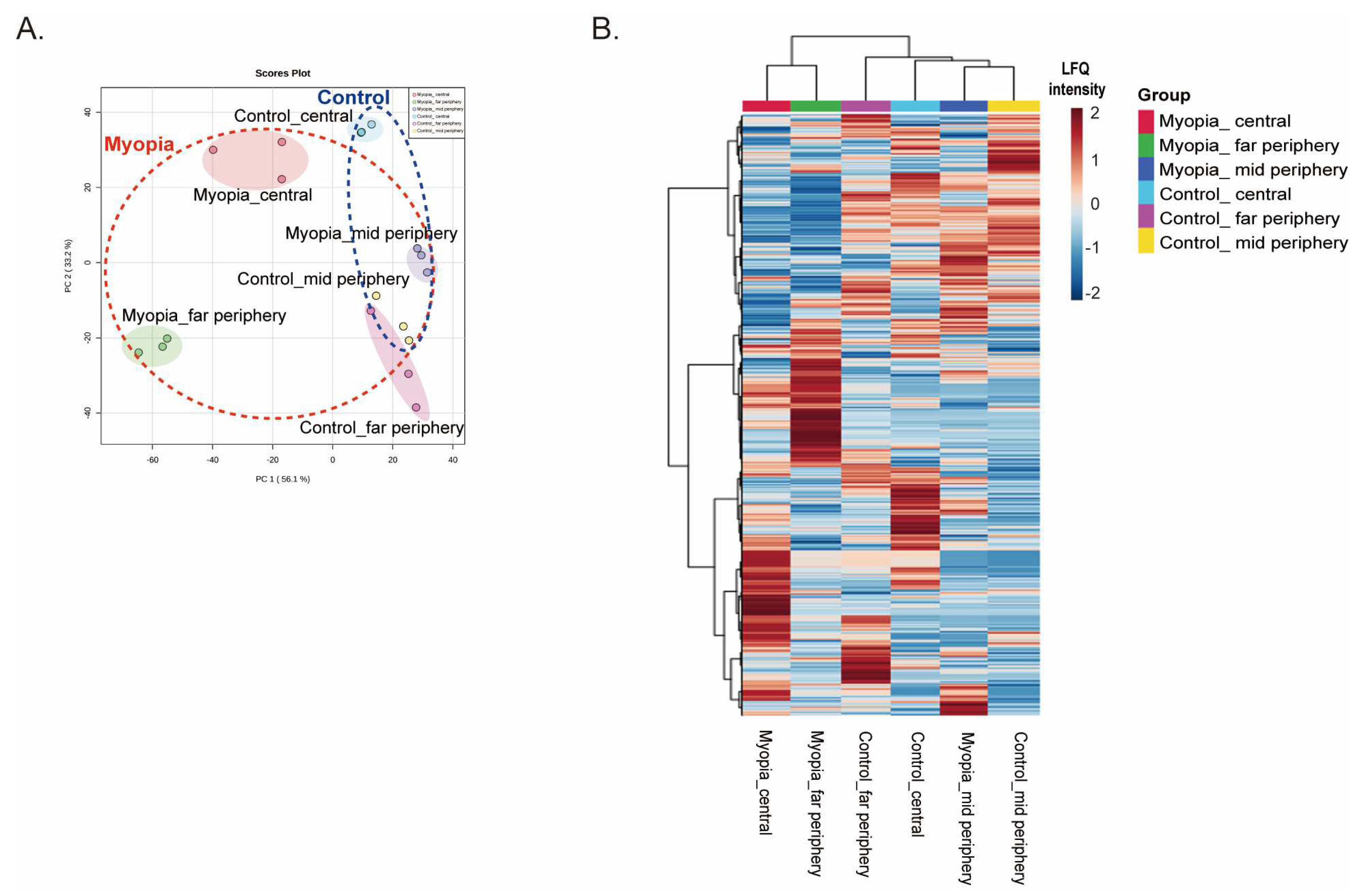 Retinal Proteome Analysis Reveals a Region-Specific Change in the ...