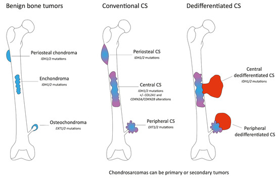 Biology and Management of High-Grade Chondrosarcoma: An Update on ...