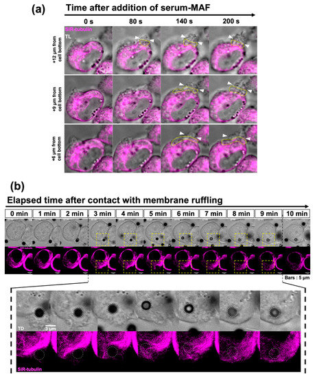 Morphological Evidence for Novel Roles of Microtubules in Macrophage ...