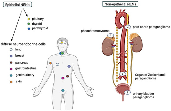 The Complex Histopathological and Immunohistochemical Spectrum of Neuroendocrine Tumors—An ...