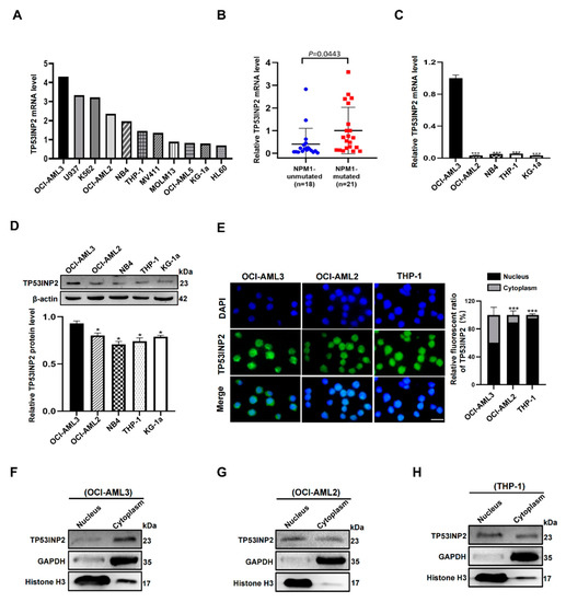 IJMS | Free Full-Text | Cytoplasmic Expression of TP53INP2 Modulated by ...
