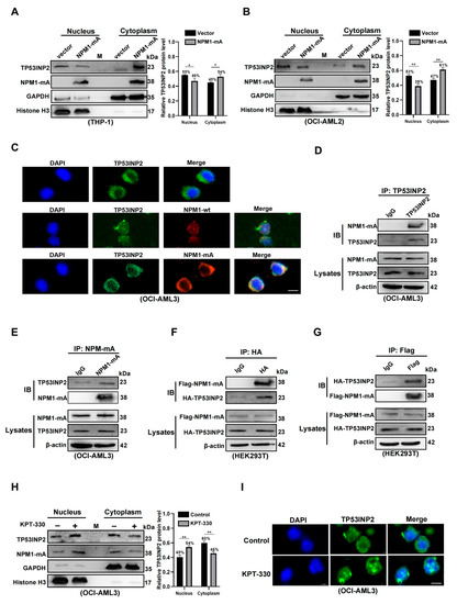 IJMS | Free Full-Text | Cytoplasmic Expression of TP53INP2 Modulated by ...