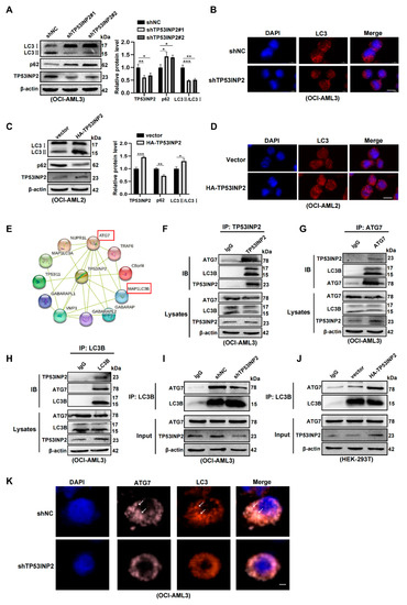 IJMS | Free Full-Text | Cytoplasmic Expression of TP53INP2 Modulated by ...