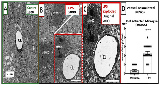Ultrastructural Remodeling of the Blood–Brain Barrier and Neurovascular ...