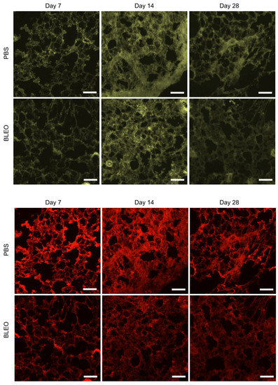 Multi-Step Extracellular Matrix Remodelling and Stiffening in the ...