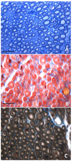 Morphological Methods to Evaluate Peripheral Nerve Fiber Regeneration ...