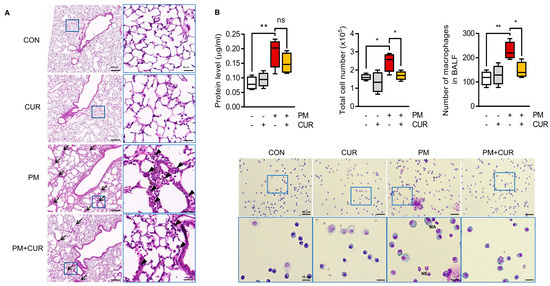 Curcumin Ameliorates Particulate Matter-Induced Pulmonary Injury ...