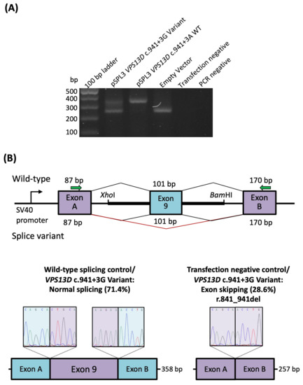 Not to Miss: Intronic Variants, Treatment, and Review of the Phenotypic ...