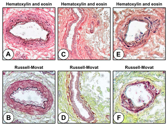Venule Histology