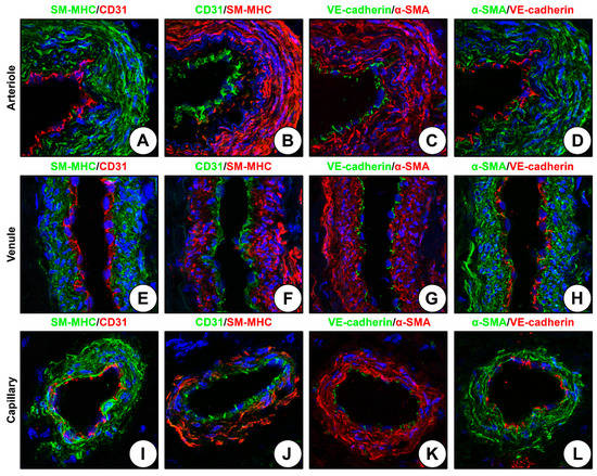 Endothelial Cell Markers Are Inferior to Vascular Smooth Muscle Cells ...