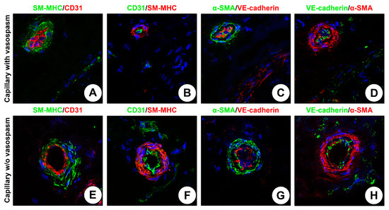 IJMS | Free Full-Text | Endothelial Cell Markers Are Inferior to Vascular Smooth Muscle Cells ...