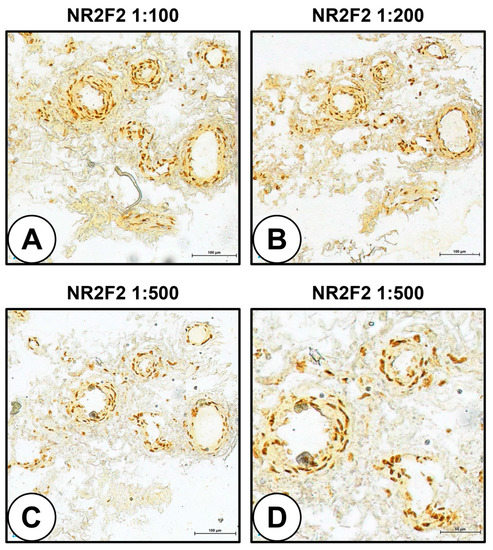 Endothelial Cell Markers Are Inferior to Vascular Smooth Muscle Cells ...