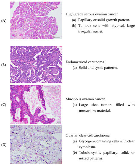 IJMS | Free Full-Text | Predicting Prognosis and Platinum Resistance in ...