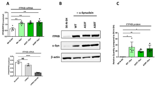 IJMS | Free Full-Text | Increased Levels of the Parkinson’s Disease ...