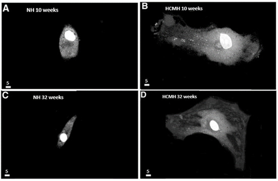 Morphological and Functional Remodeling of Vascular Endothelium in ...