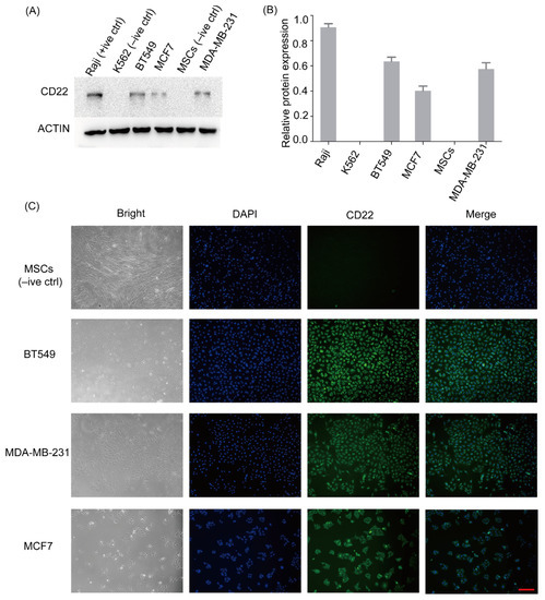 Expression of CD22 in Triple-Negative Breast Cancer: A Novel Prognostic ...