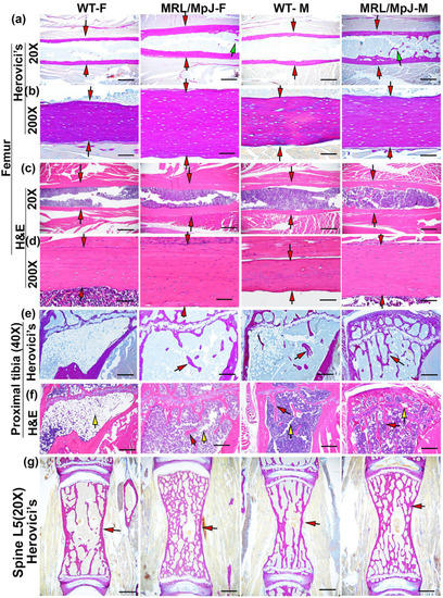 MRL/MpJ Mice Resist to Age-Related and Long-Term Ovariectomy-Induced ...