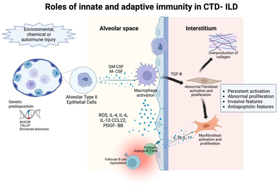 Understanding Interstitial Lung Diseases Associated with Connective Tissue Disease (CTD-ILD ...