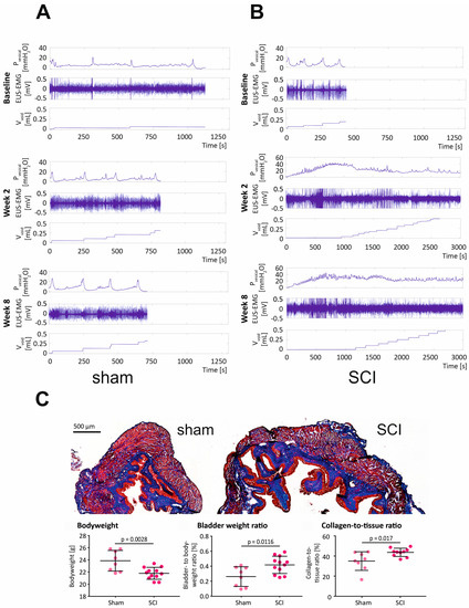 Molecular Characterization of Non-Neurogenic and Neurogenic Lower ...