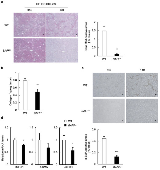 Role of B Cell-Activating Factor in Fibrosis Progression in a Murine ...