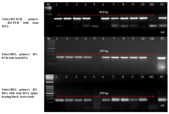 Development of Reverse Transcription Recombinase Polymerase ...