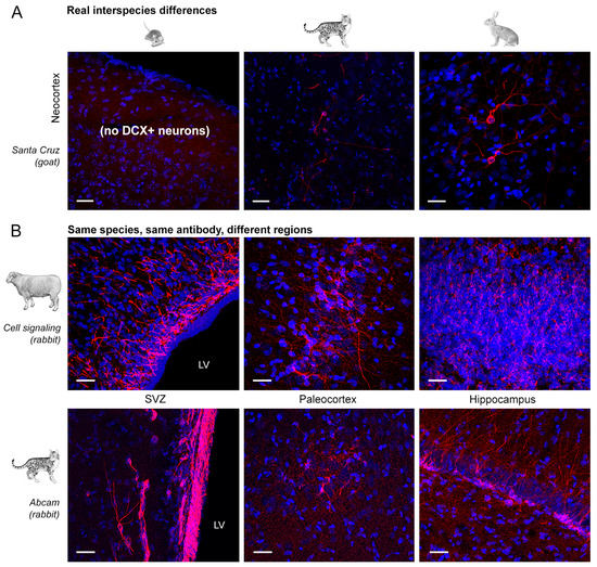 Consistency and Variation in Doublecortin and Ki67 Antigen Detection in ...