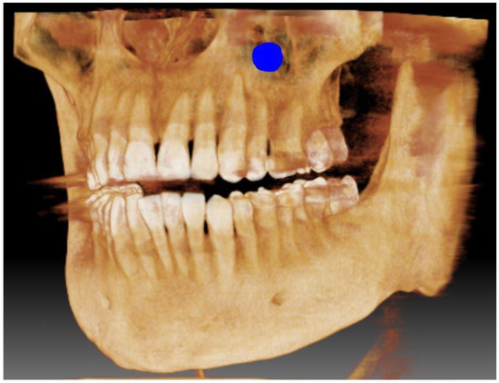 The Influence of Environmental Exposure to Heavy Metals on the ...