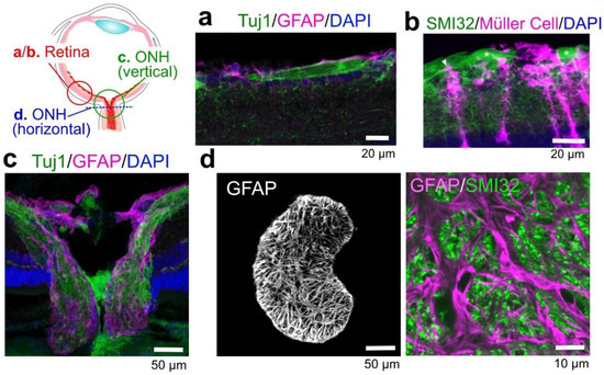 Astrocyte Immune Functions and Glaucoma