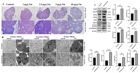 The Activation of Reticulophagy by ER Stress through the ATF4-MAP1LC3A ...