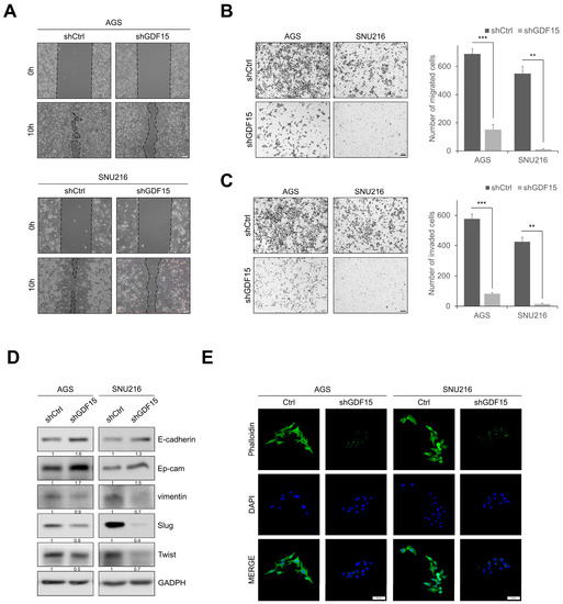 GDF15 Promotes Cell Growth, Migration, and Invasion in Gastric Cancer ...