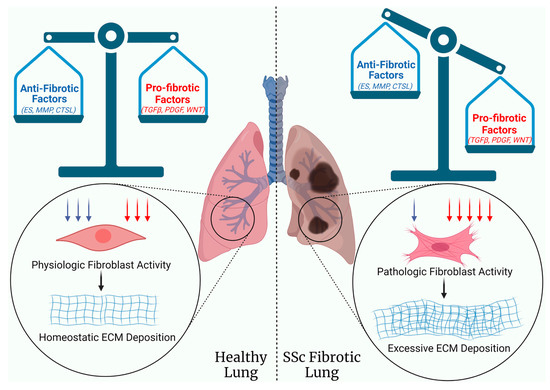 IJMS | Free Full-Text | The Molecular Mechanisms of Systemic Sclerosis-Associated Lung Fibrosis