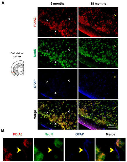 PDIA3 Expression Is Altered in the Limbic Brain Regions of Triple ...