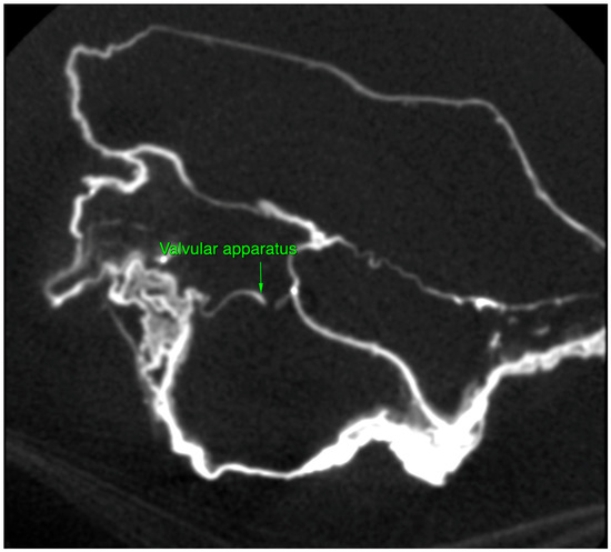 Deep Paleoproteotyping and Microtomography Revealed No Heart Defect nor ...