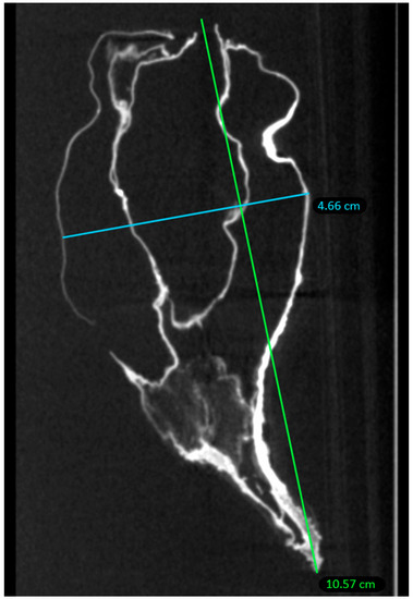 Deep Paleoproteotyping and Microtomography Revealed No Heart Defect nor ...