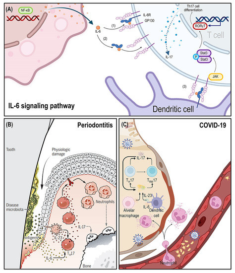 Periodontitis and COVID-19: Immunological Characteristics, Related Pathways, and Association