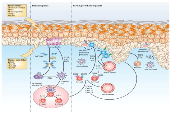 Comprehensive Insight into Lichen Planus Immunopathogenesis