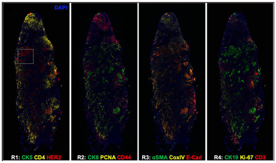 Multiplex Immunofluorescence: A Powerful Tool in Cancer Immunotherapy