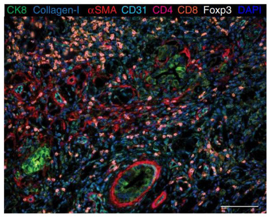 Multiplex Immunofluorescence: A Powerful Tool in Cancer Immunotherapy