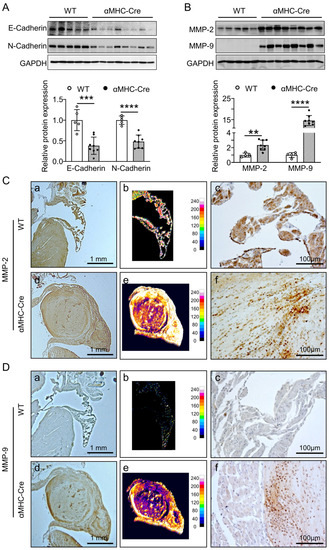 Cardiac-Specific Expression of Cre Recombinase Leads to Age-Related ...