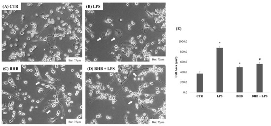 The Ketogenic Diet and Neuroinflammation: The Action of Beta ...
