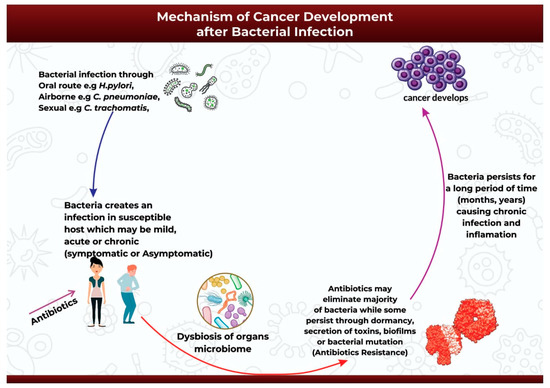 Bacterial Infections and Cancer: Exploring This Association And Its ...