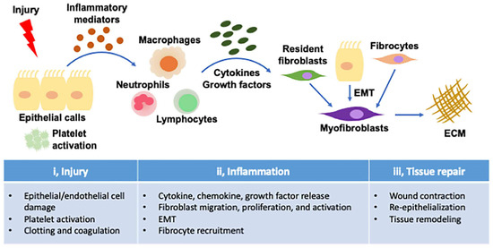 Immune Mechanisms of Pulmonary Fibrosis with Bleomycin