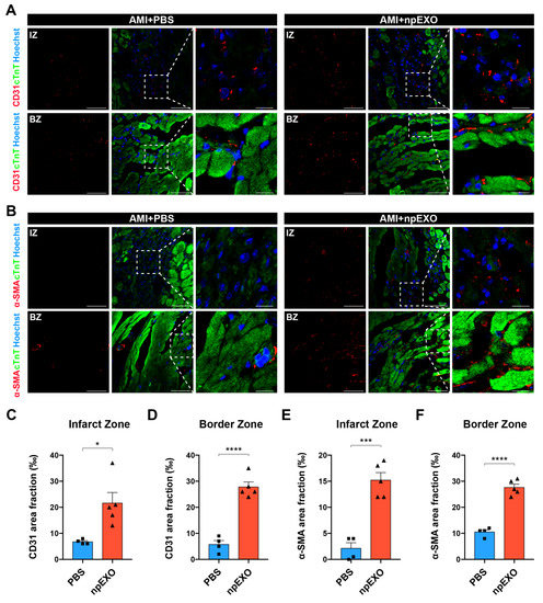 Neonatal Plasma Exosomes Contribute to Endothelial Cell-Mediated ...