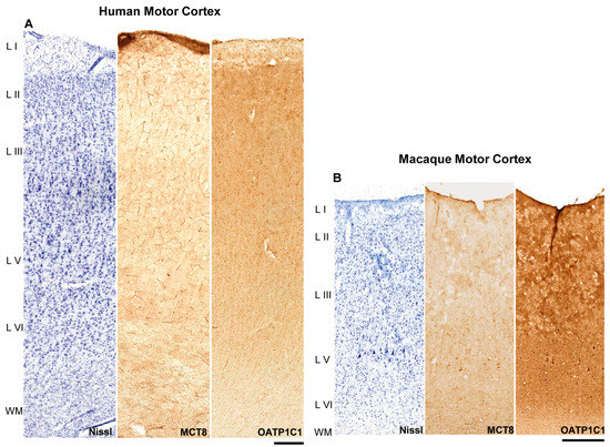 Thyroid Hormone Transporters MCT8 and OATP1C1 Are Expressed in ...