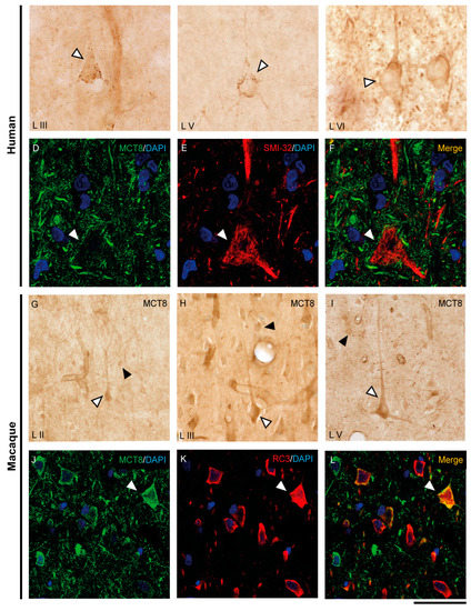 Thyroid Hormone Transporters MCT8 and OATP1C1 Are Expressed in ...